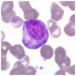 @Nãotemmaisfim@: Mielócitos